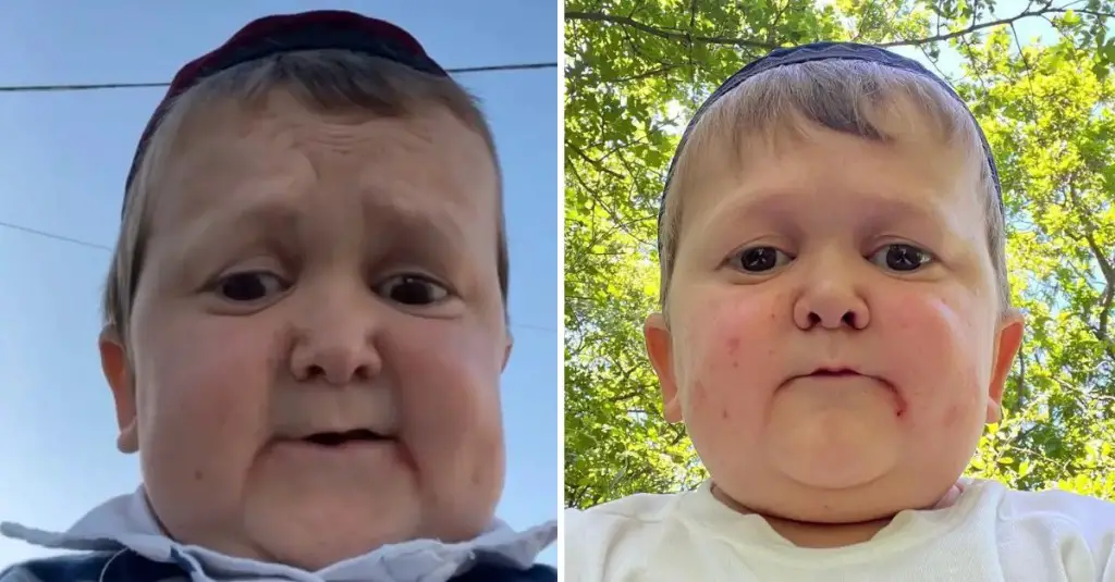 Hasbulla Breaks Silence After His Arrest - The Hook news