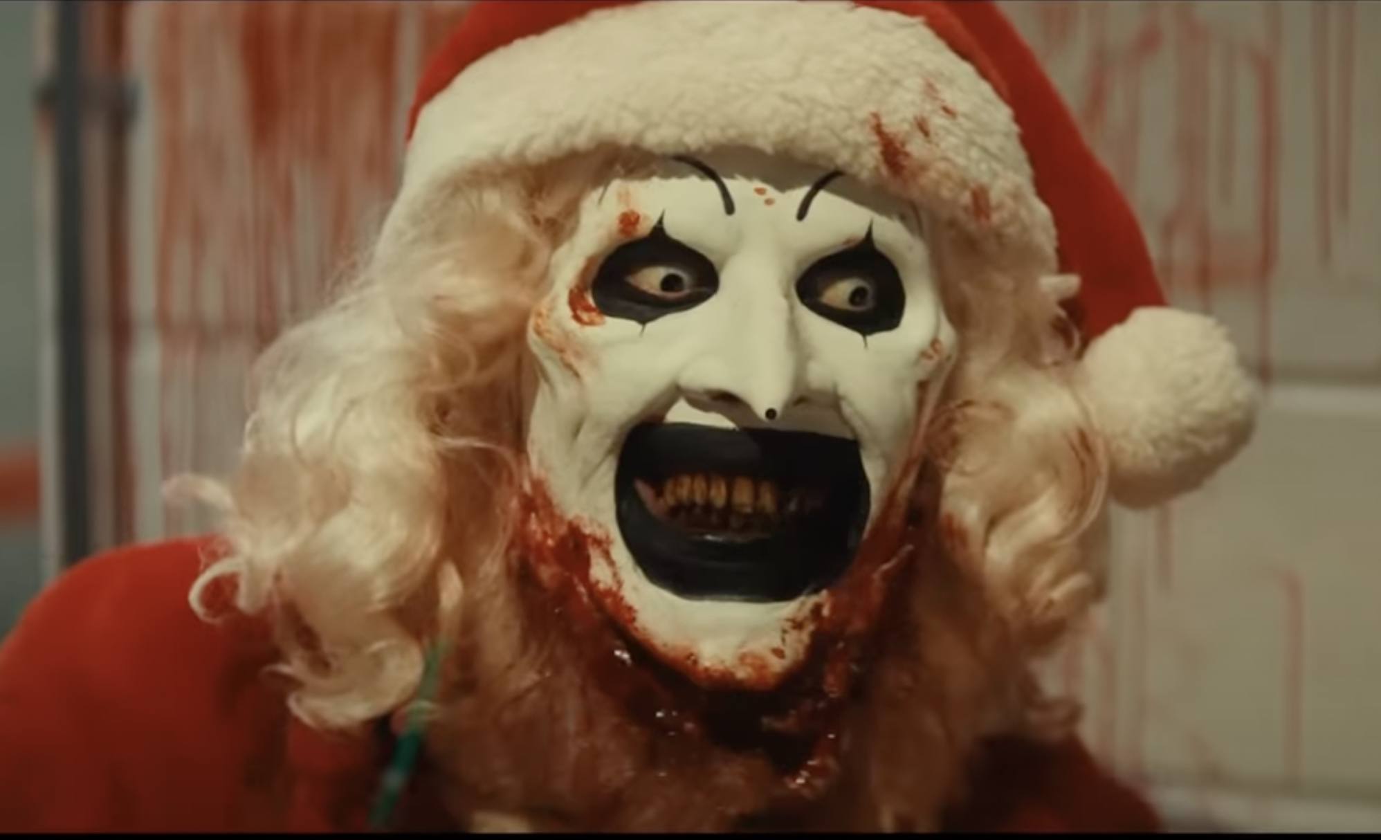 Woman Was ‘Fighting for Her Life’ and Got Numerous Health Warnings ...